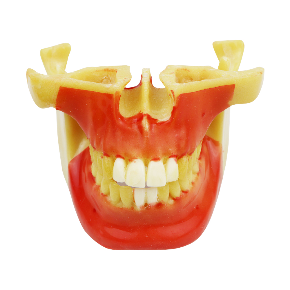 IDENTical Ortho Implant Practice With Soft Tissue Model M2031 Online At IDENTical Ortho Implant Practice With Soft Tissue Model M2031 Online At