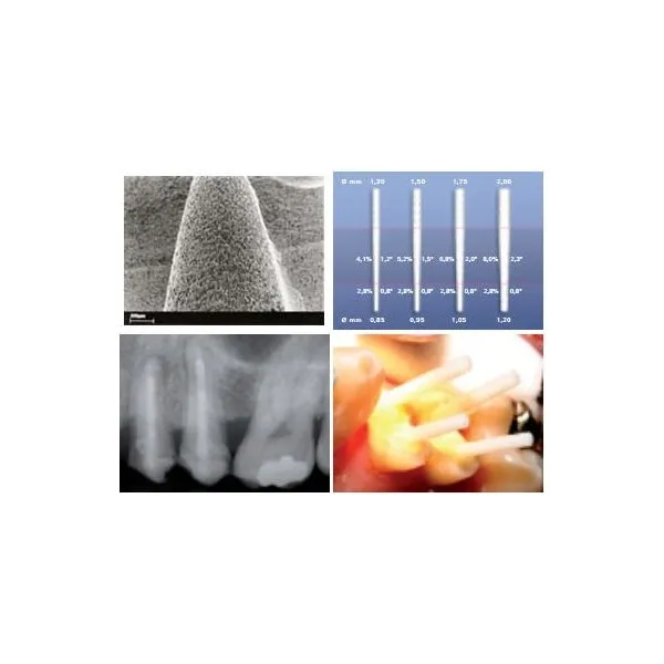 Fiber Post: Buy Fiber Post Online at Best Price | Dentalkart.com