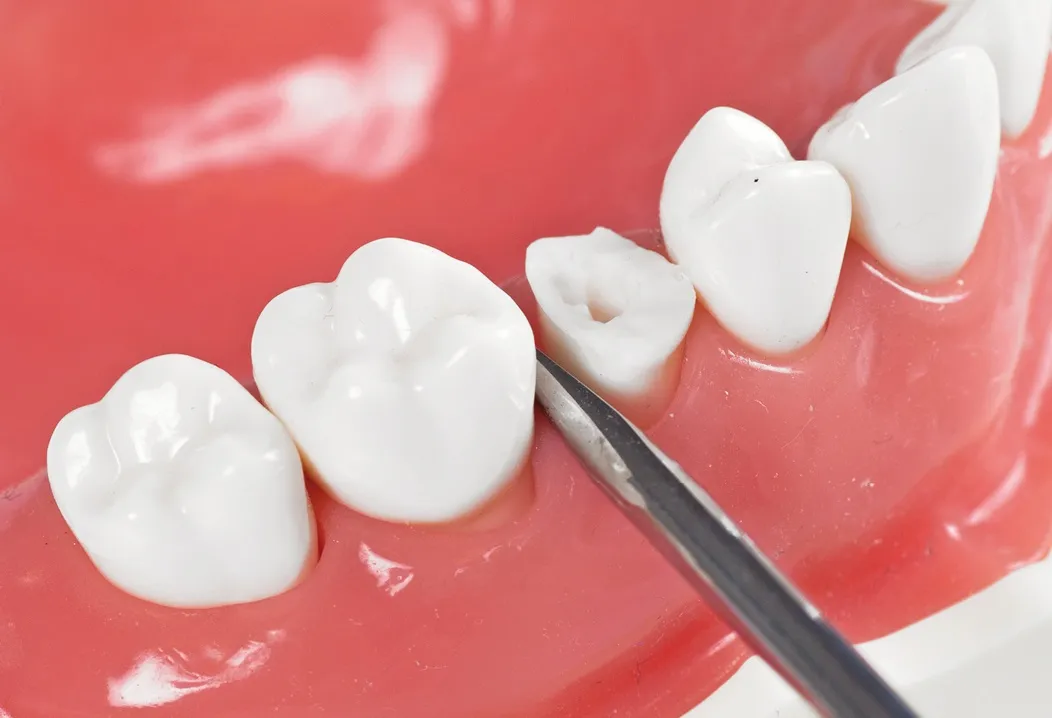 Waldent Luxators Online at Best Price | Dentalkart.com